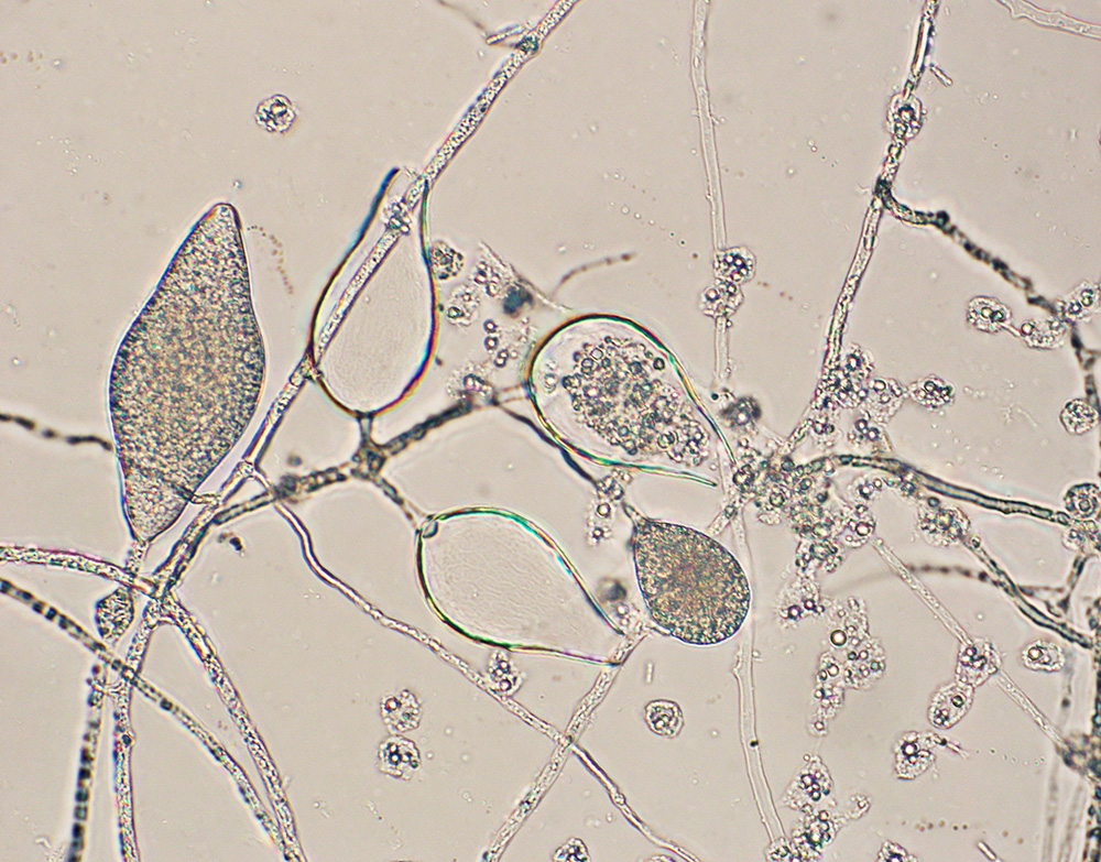 Phytophthora Diseases of Row Crops: A Review | Progressive Crop Consultant